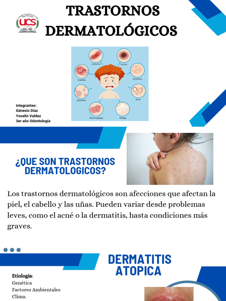 Dermatitis Seborreica en Trastornos Dermatológicos | PDF ...