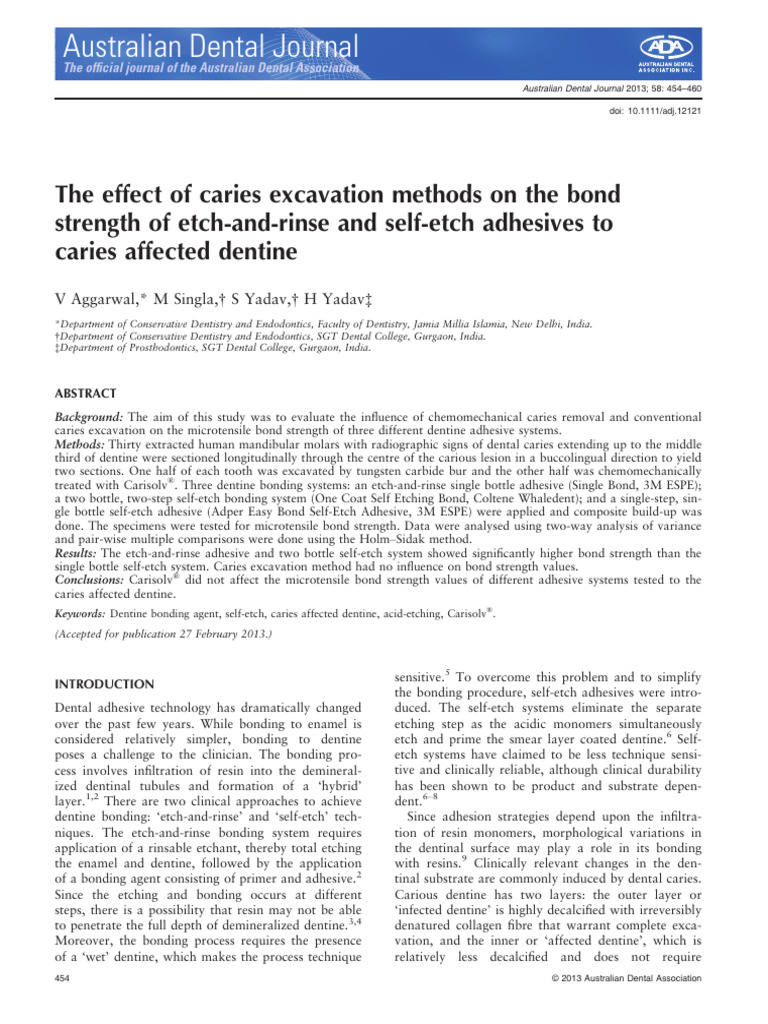 The Effect of Caries Excavation Methods On The Bond Strength of Etch ...