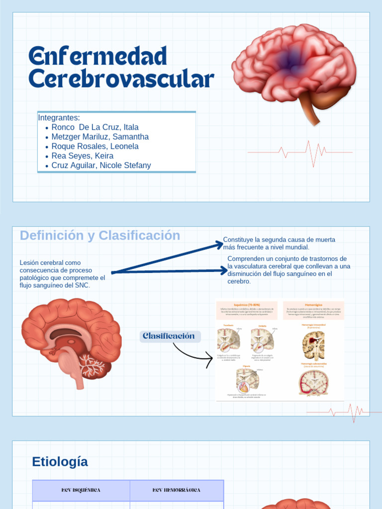 Grupo 5 - Enfermedad Cerebrovascular PDF | PDF
