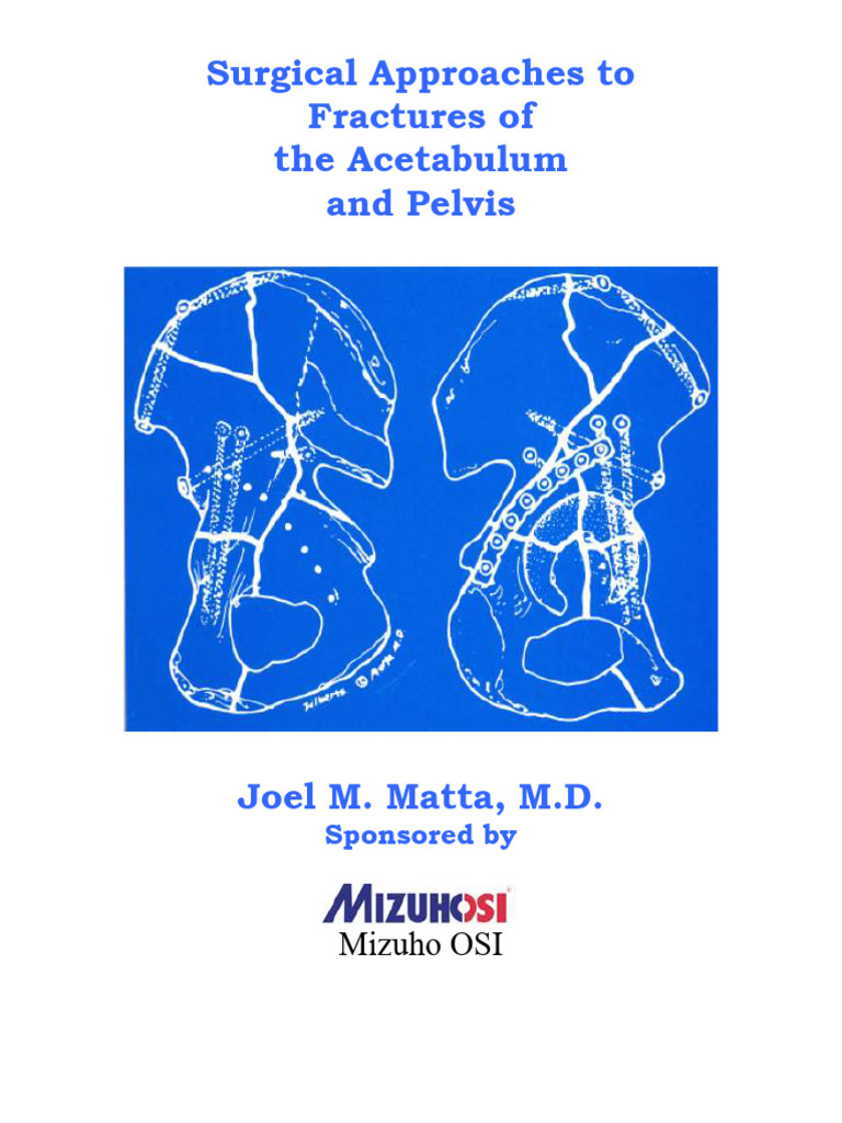 Approaches To The Acetabulumcomplete | PDF | Pelvis | Soft Tissue