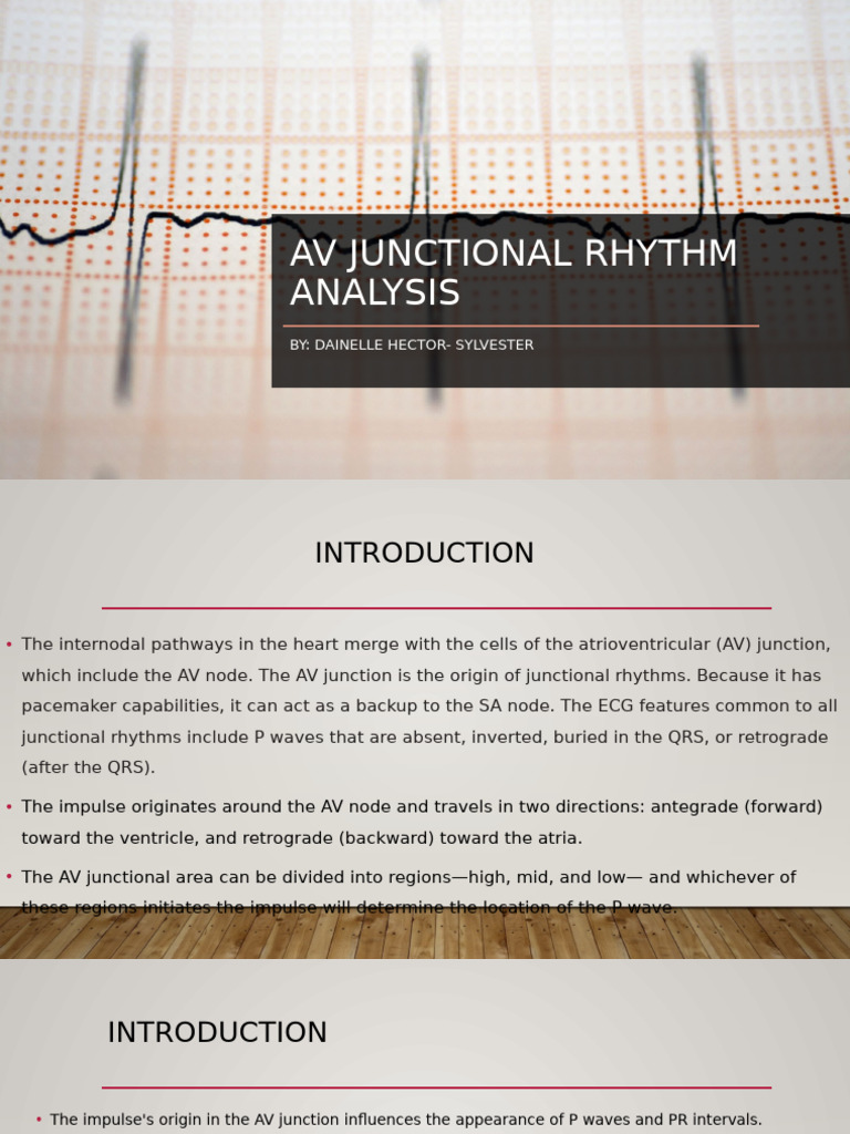 AV Junctional Rhythm Analysis | PDF | Internal Medicine | Cardiac Arrhythmia