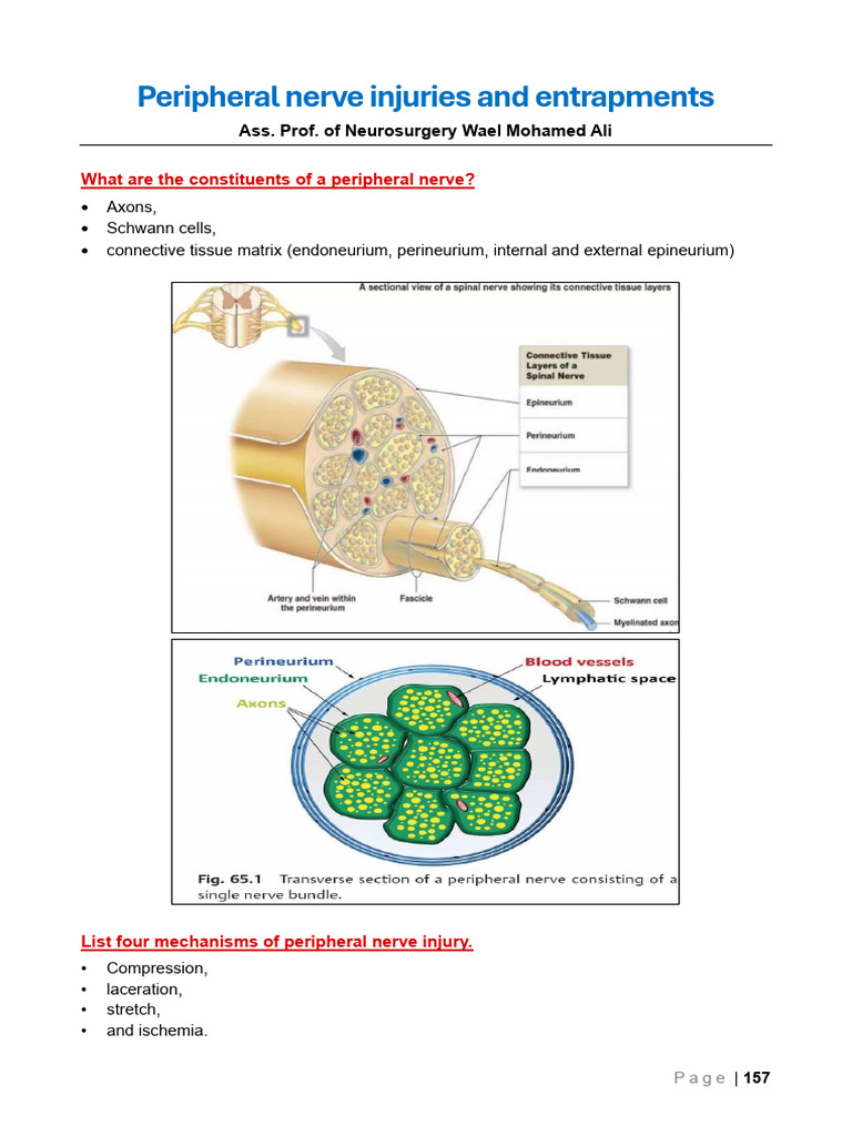Peripheral Nerve Injuries Overview | PDF | Thumb | Carpal Tunnel Syndrome