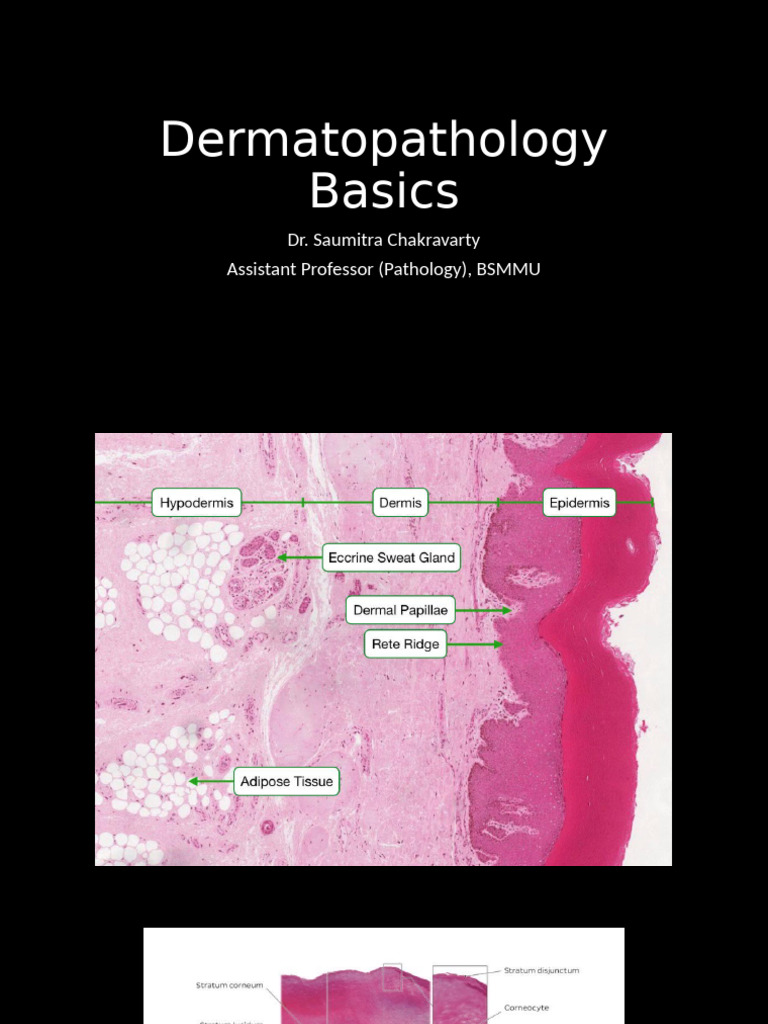 Dermatopathology | PDF