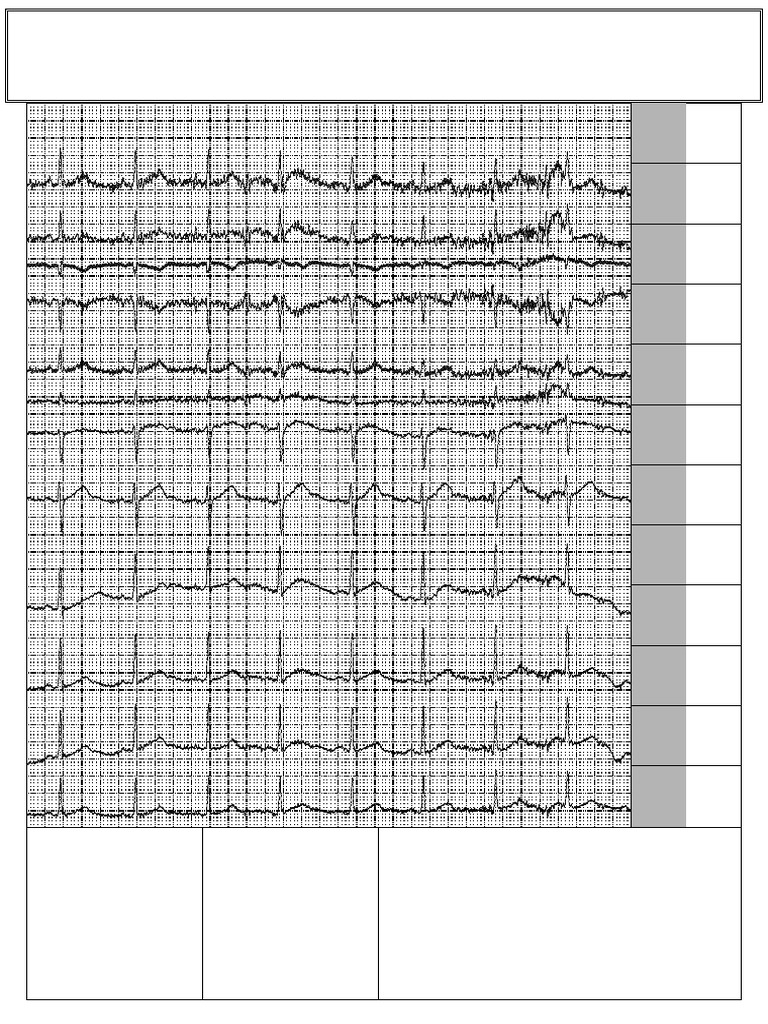 Informe ECG de Jorge Orlando | PDF | Electrofisiología cardíaca ...