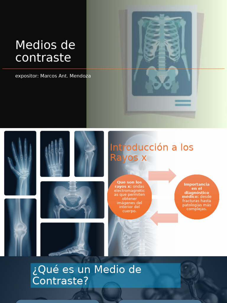 Medios de Contraste | PDF | Ct Scan | Tracto gastrointestinal