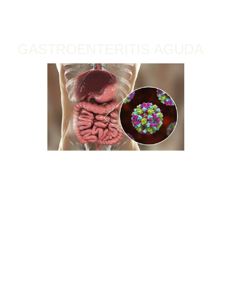 8 Gastroenteritis Aguda (1) .PPTX - 20250330 - 000523 - 0000 | PDF ...
