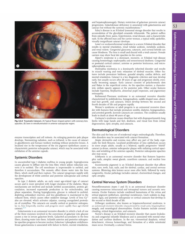 Opthalmology-p333 | PDF