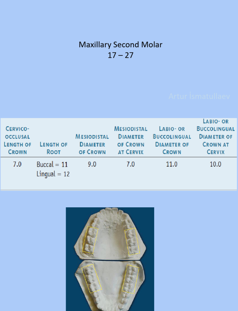 13_maxillary 2. molar | PDF | Dental Anatomy | Tooth