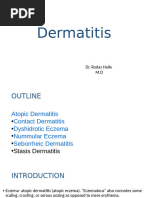 Dyshidrotic Eczema (Pompholyx, Vesicular Hand Eczema) - DermNet | PDF ...