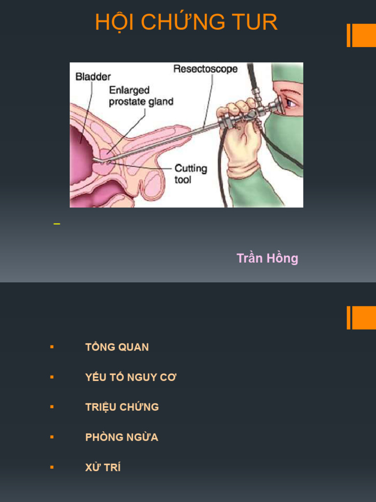 Turp Syndrome | PDF