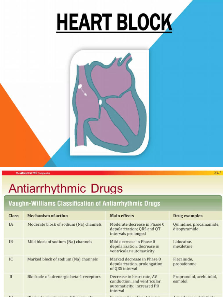 Heart Block PPT Final | PDF