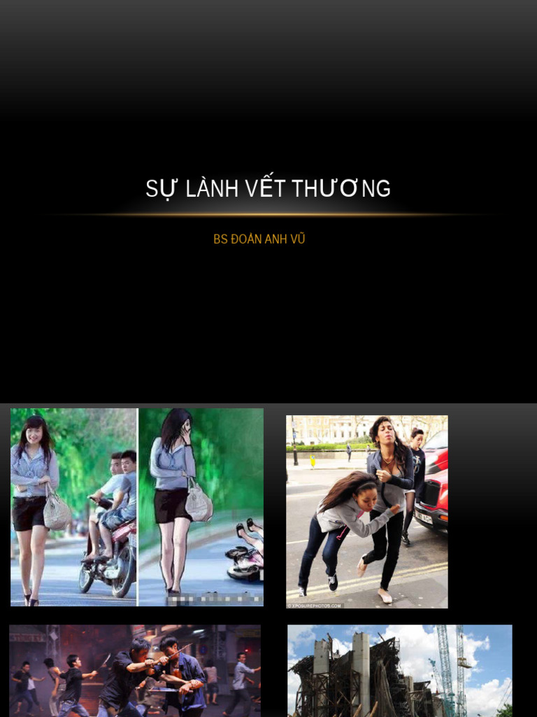 Su Lanh Vet Thuong | PDF