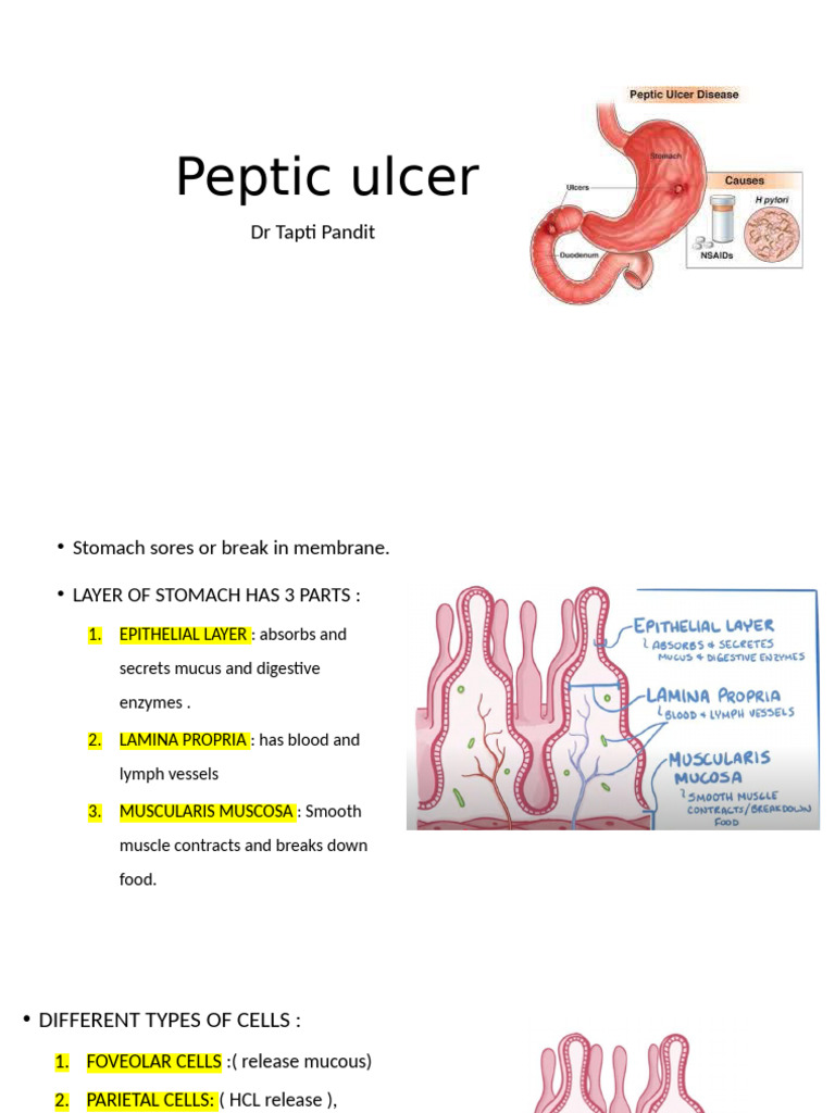 Peptic Ulcer Overview and Treatment | PDF | Stomach | Gastroenterology