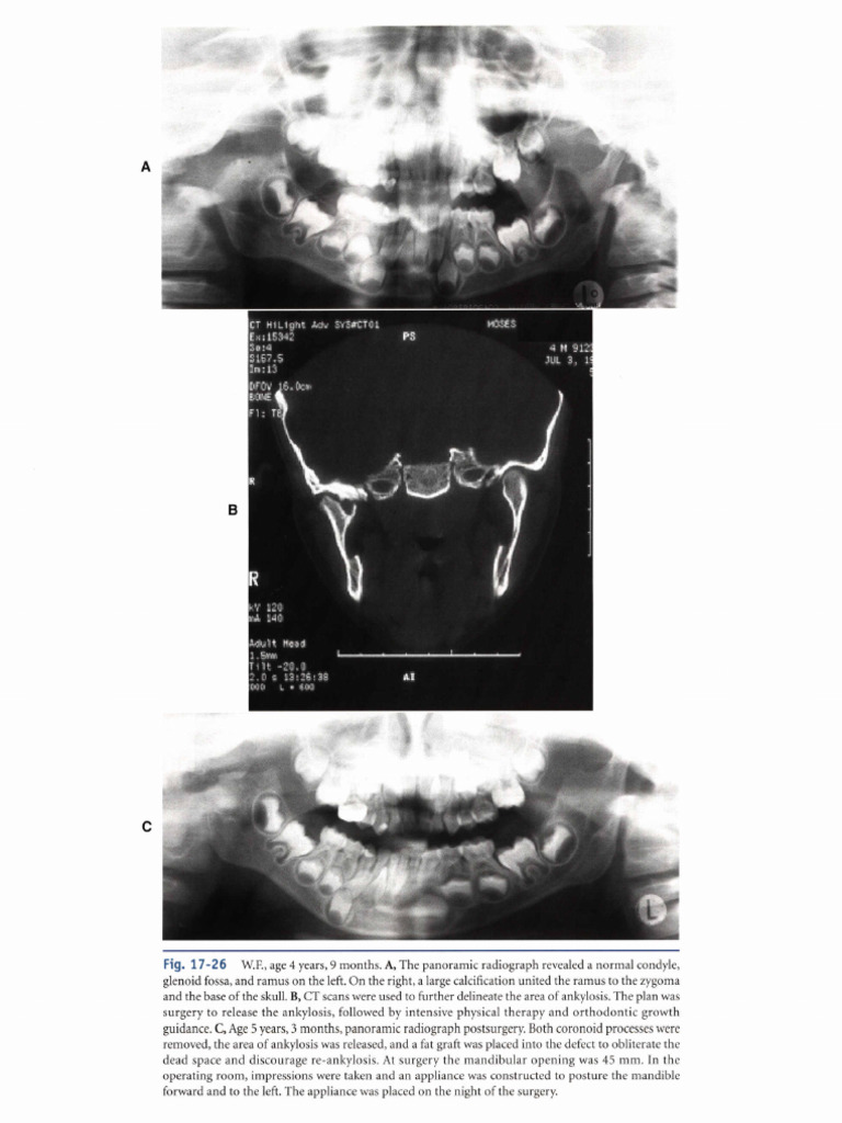 2003 Dentallib William R Proffit-580-650 (25-50) | PDF | Dentistry Branches