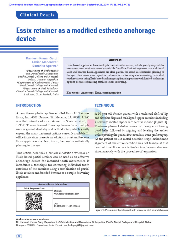 Essix Retainer As A Modified Esthetic Anchorage de | PDF | Orthodontics ...