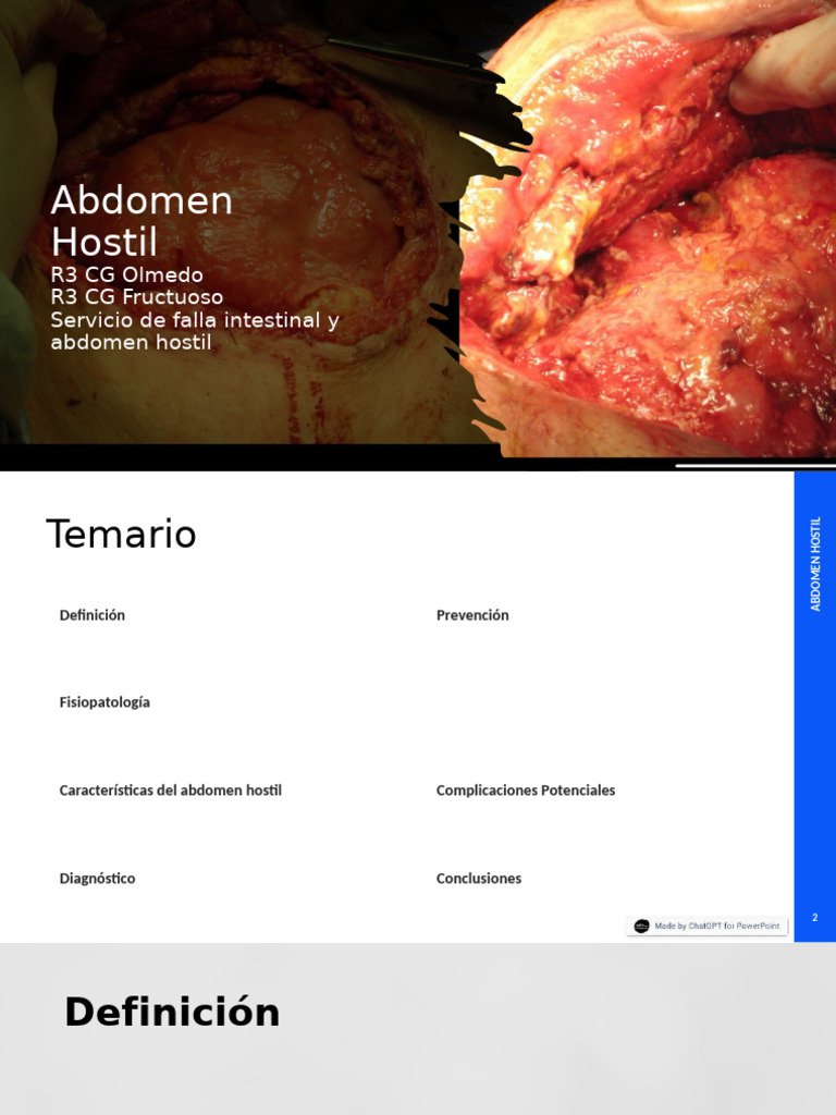 Abdomen Hostil: Definición y Manejo | PDF | Septicemia | Abdomen