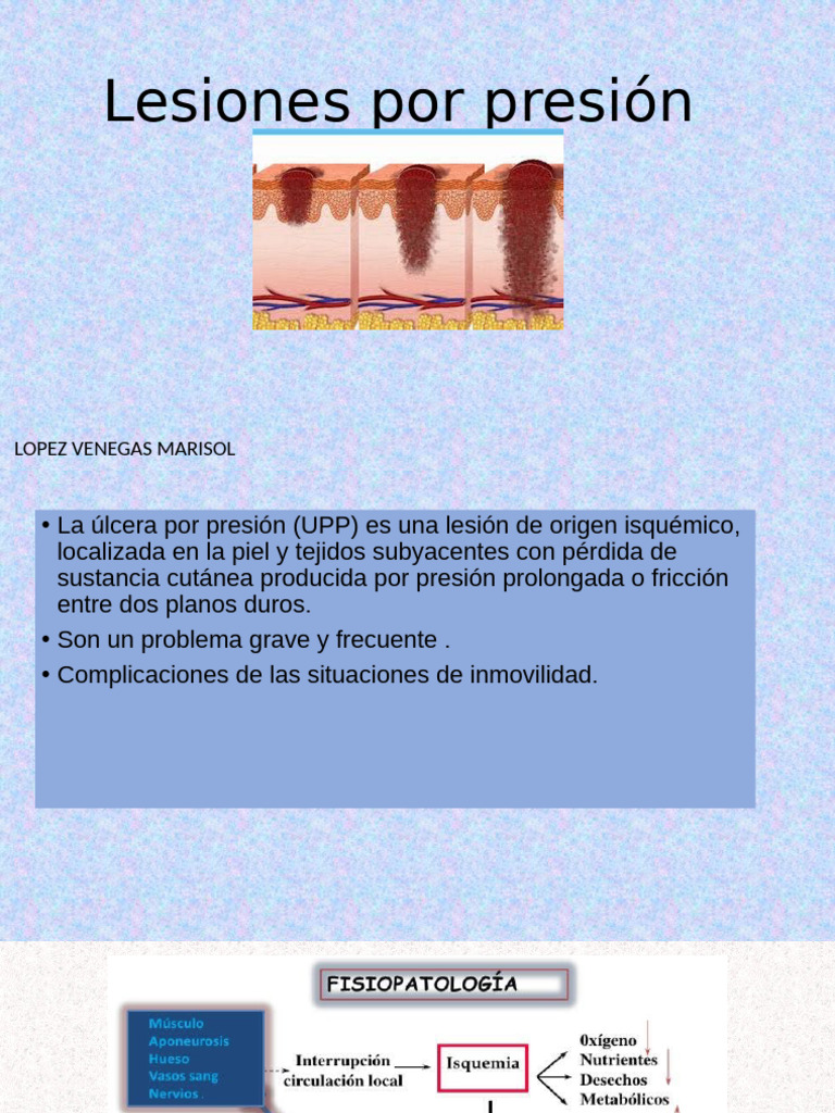 Lesiones Por Presión | PDF | Isquemia | Fricción