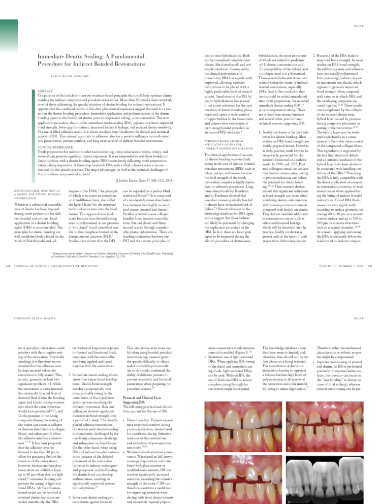 Immediate Dentin Sealing - A Fundamental Procedure For Indirect Bonded Restorations | PDF ...