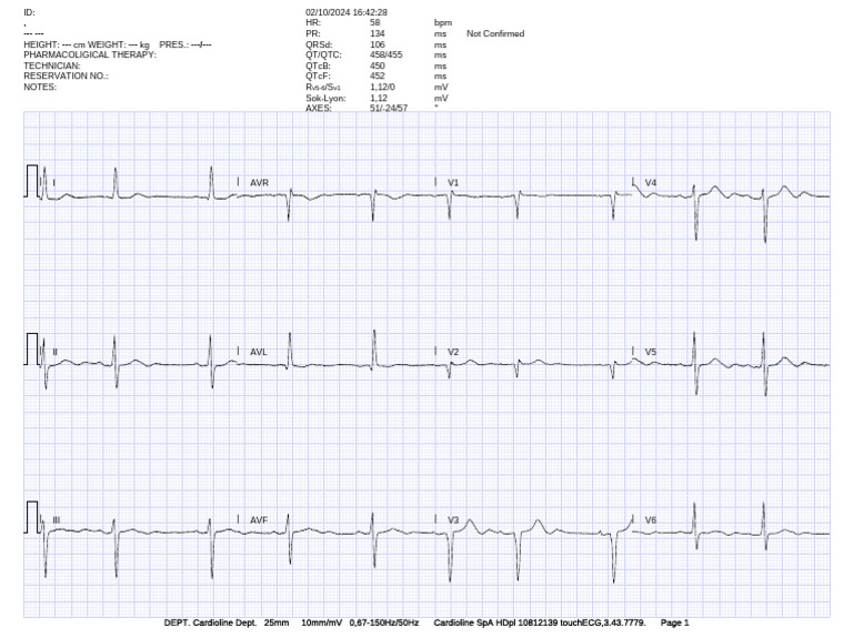 ECG Report: 130 BPM Analysis | PDF