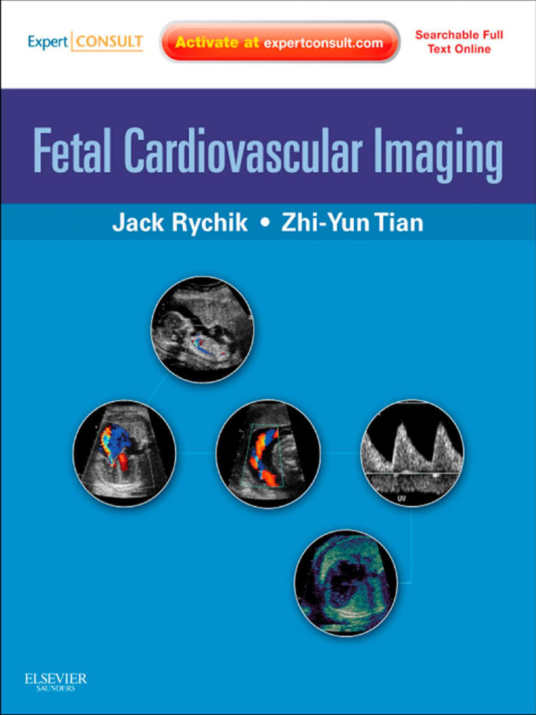 Fetal Cardiovascular Imaging - A Disease Based Approach | PDF | Congenital Heart Defect | Heart ...