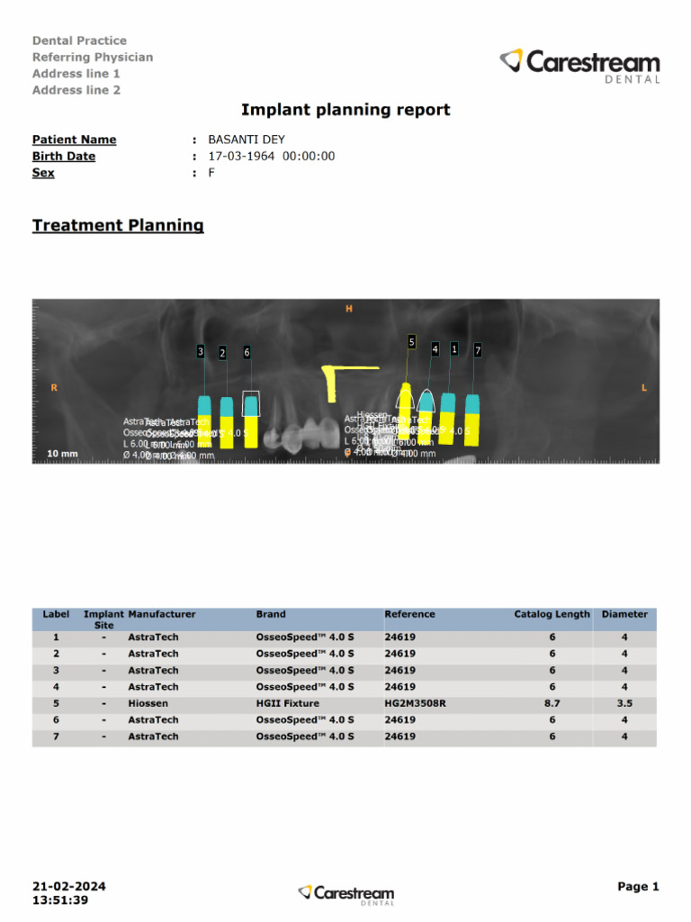 Implant Planning Irt Maxilla | PDF