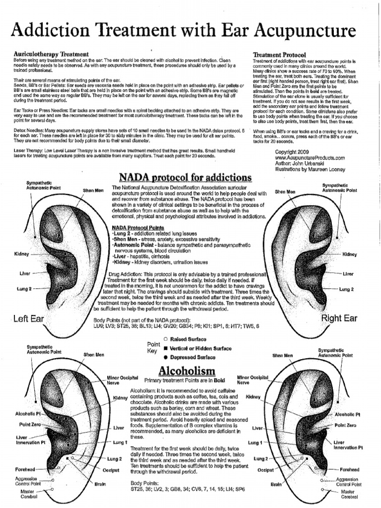 Auricular Addiction Protocols Chart | PDF