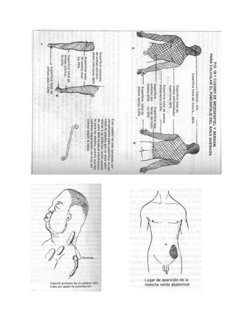 cadáver | PDF