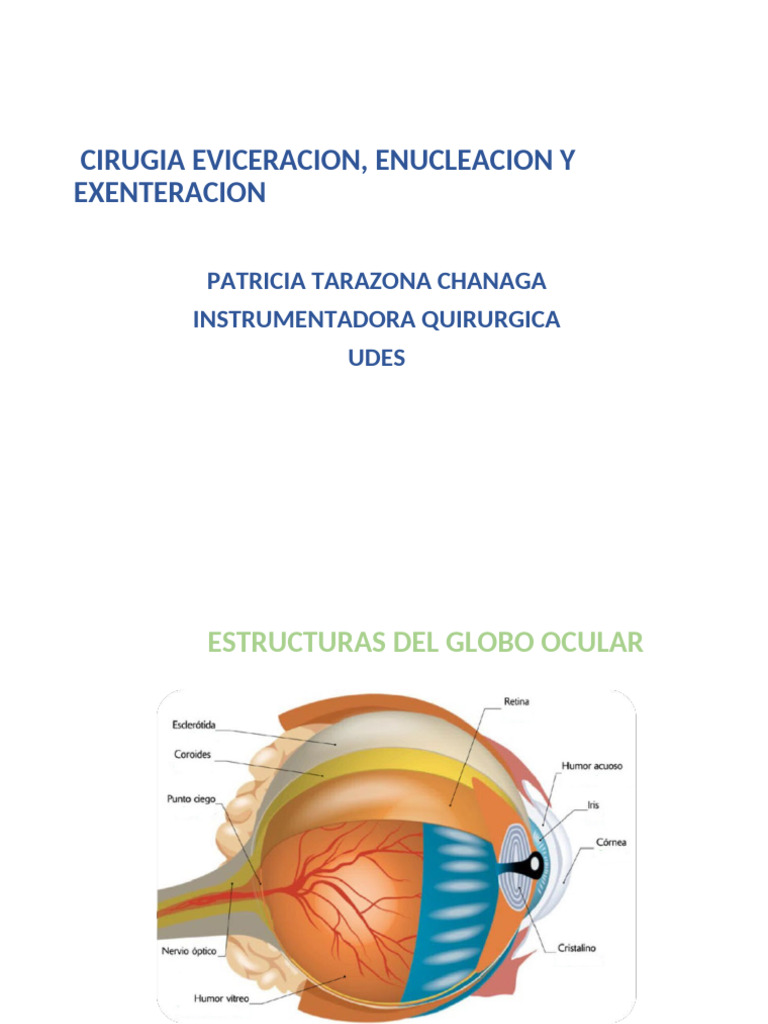 Cirugia de Enucleacion, Evisceracion y Exenteracion de Globo Ocular PTC ...