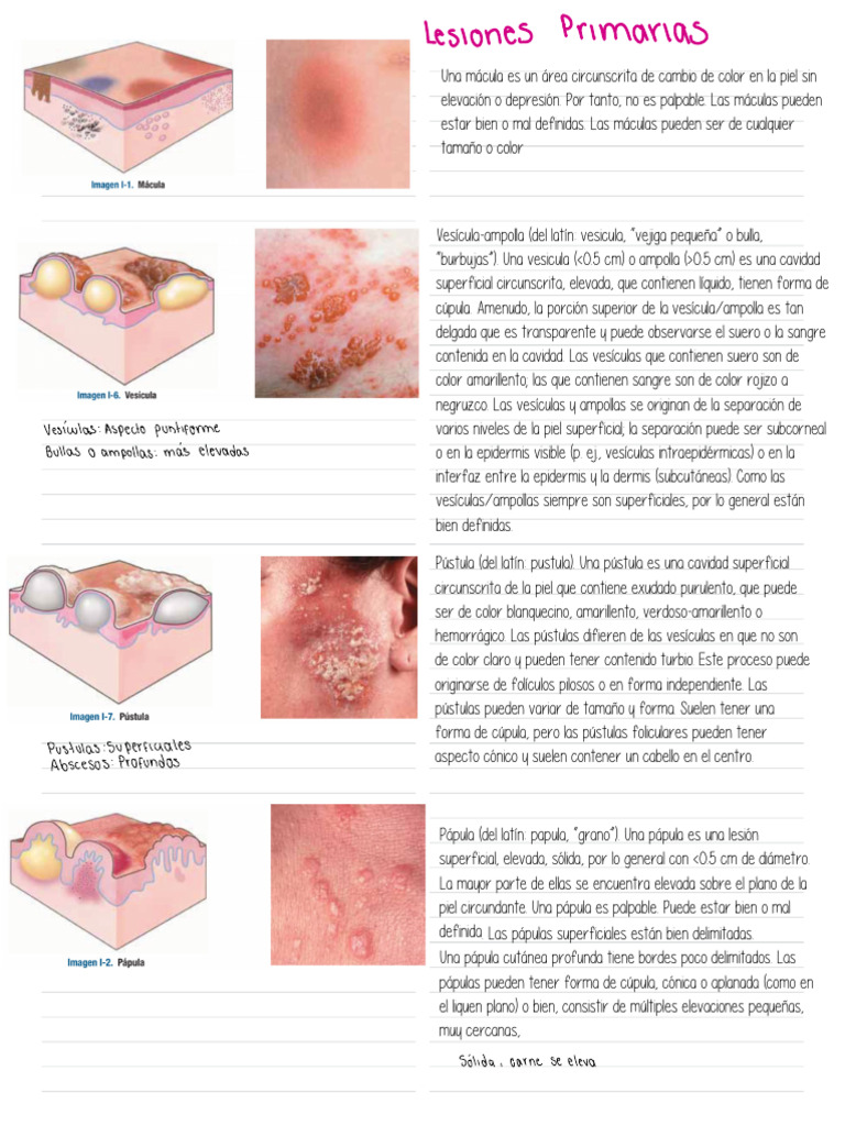 Lesiones Primarias Y Secundarias de La Piel | PDF | Piel | Condiciones ...