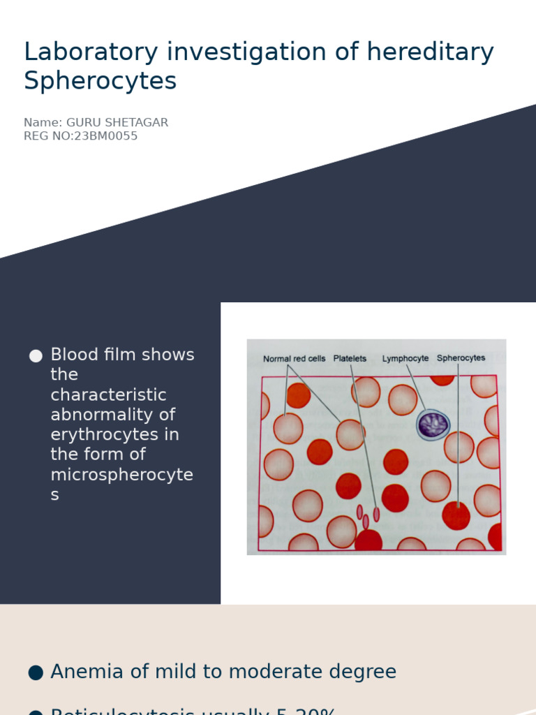 Laboratory Investigations of Hereditary Spirocytes | PDF