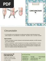 Procedimiento de Postioplastia | PDF