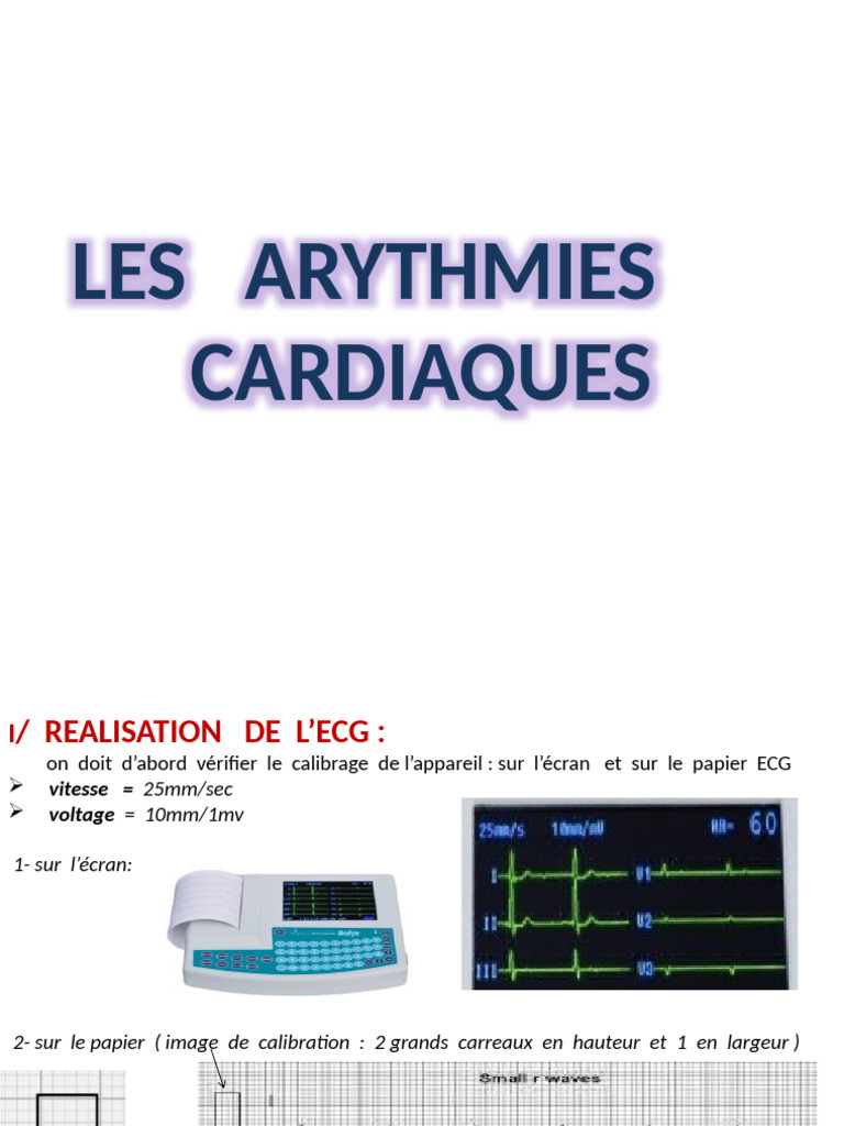 ARYTHMIES CARDIAQUES 2023 | PDF | Électrocardiographie | Électrophysiologie