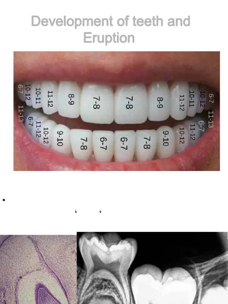 Development of Teeth and Eruption | PDF