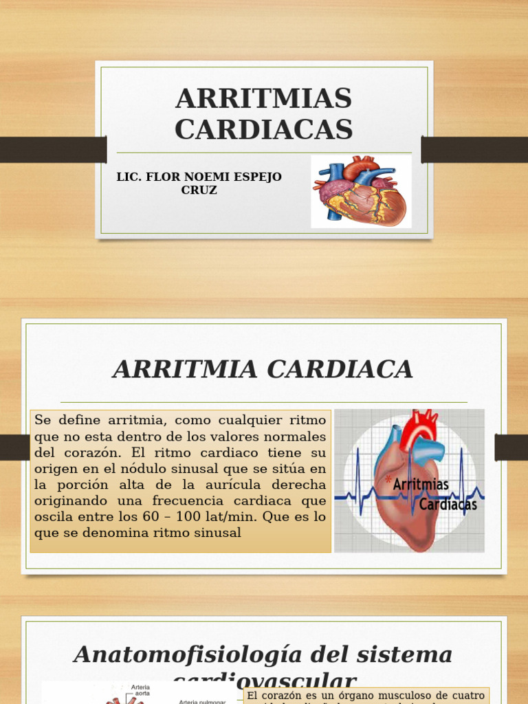 ARRITMIAS CARDIACAS | PDF | Corazón | Especialidades Medicas
