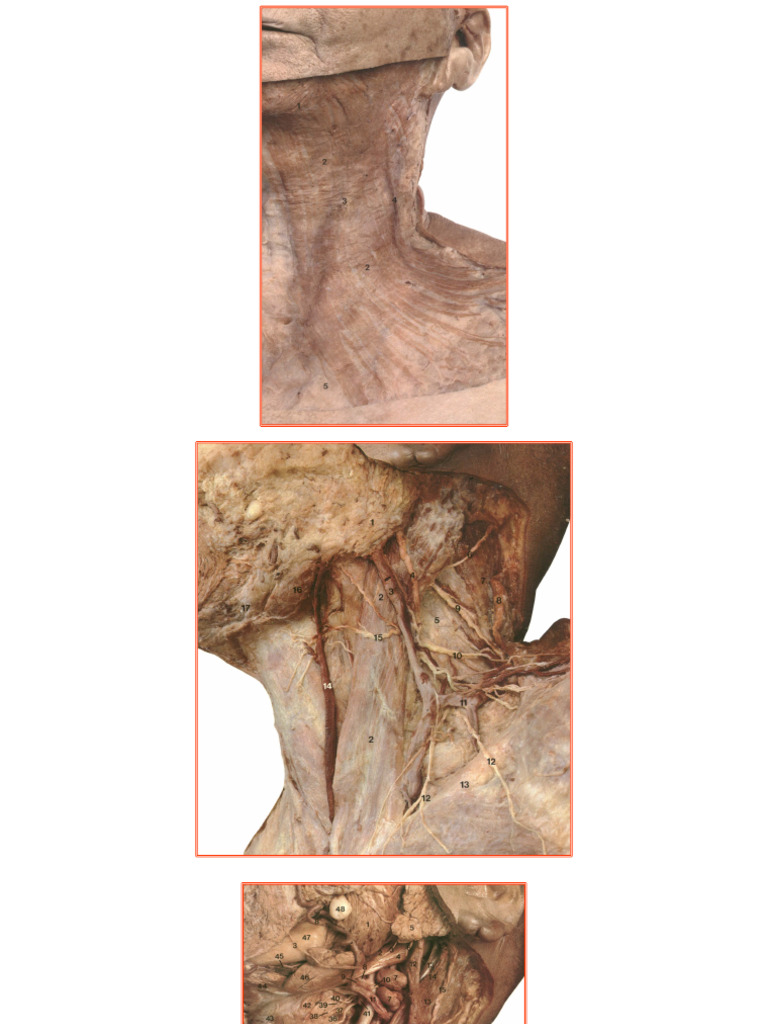 Cap Gat Imagini Cadavru | PDF