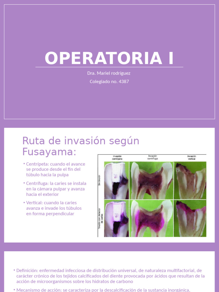 Clasificación y Mecanismos de Caries Dental | PDF | Diente | Esmalte de ...