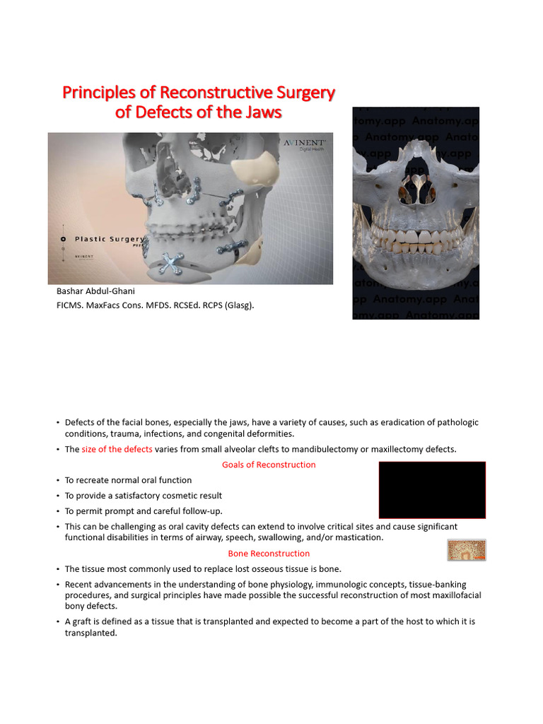 Reconstructive Surgery for Jaw Defects | PDF | Bone | Osteoblast