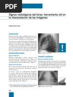 Signos Radiológicos Neumoperitoneo | PDF