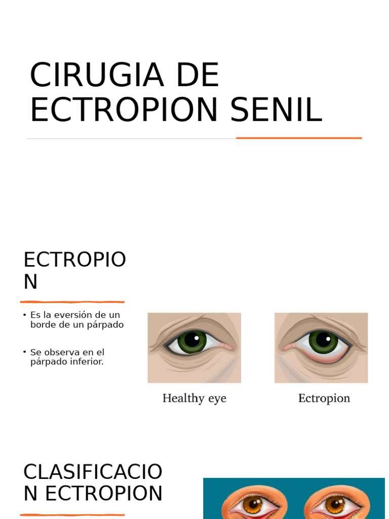 Cirugia Ectropion | PDF | Especialidades Medicas | Enfermedades y ...