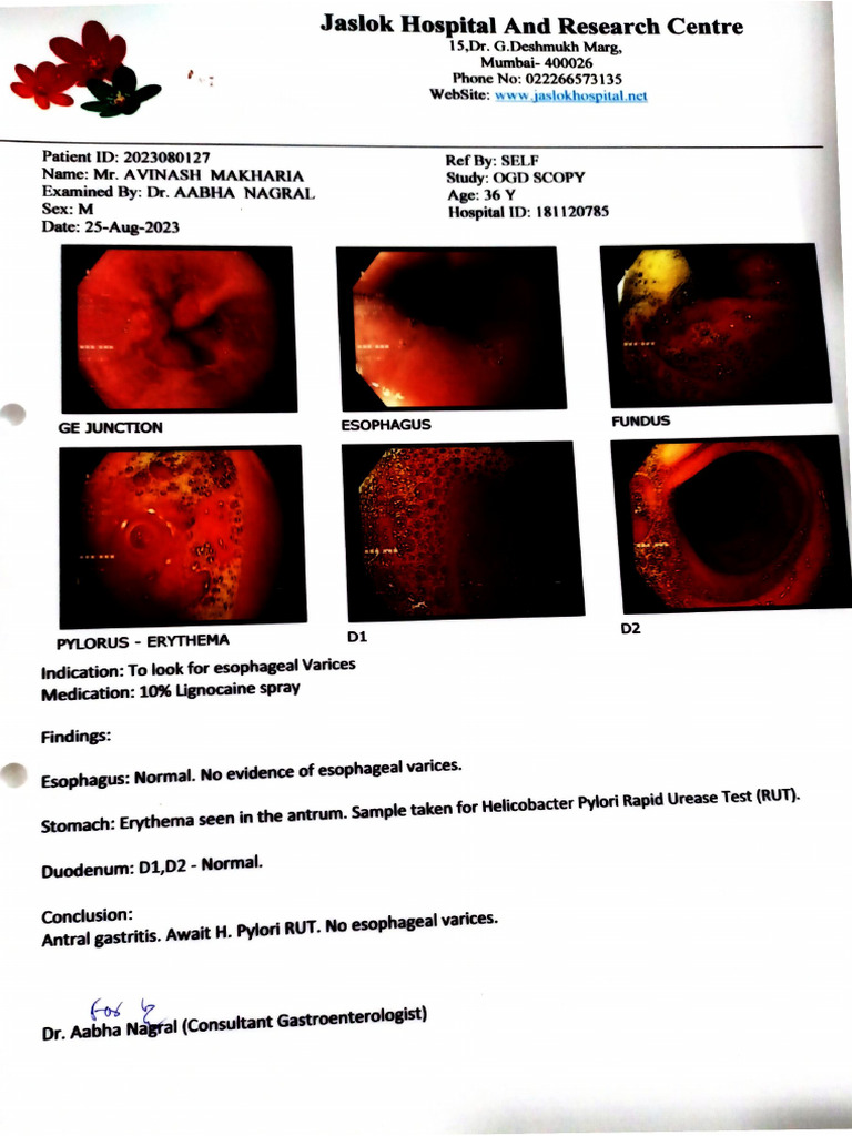 Avi Endoscopy Reports | PDF
