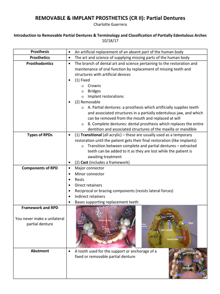 Removable & Implant Notes Main | PDF | Dentures | Dental Implant