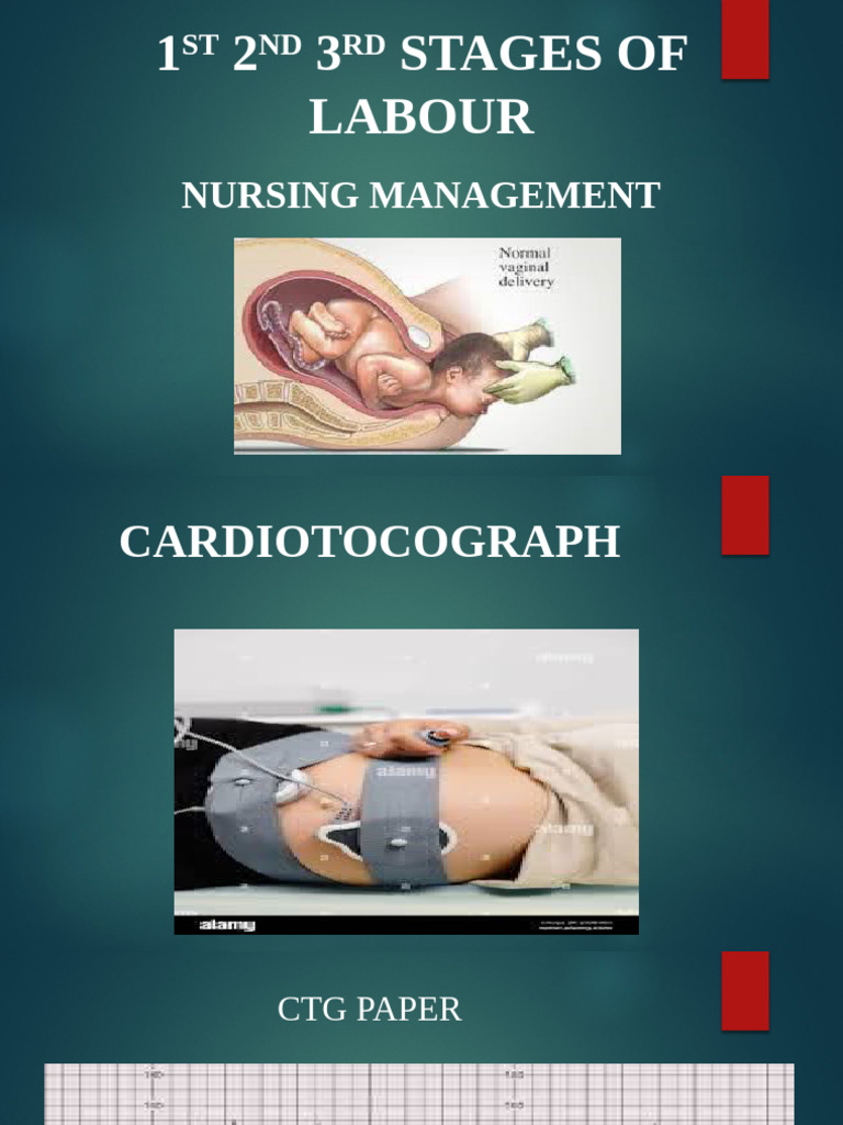 1ST 2ND 3RD STAGES OF LABOUR SEMINAR | PDF