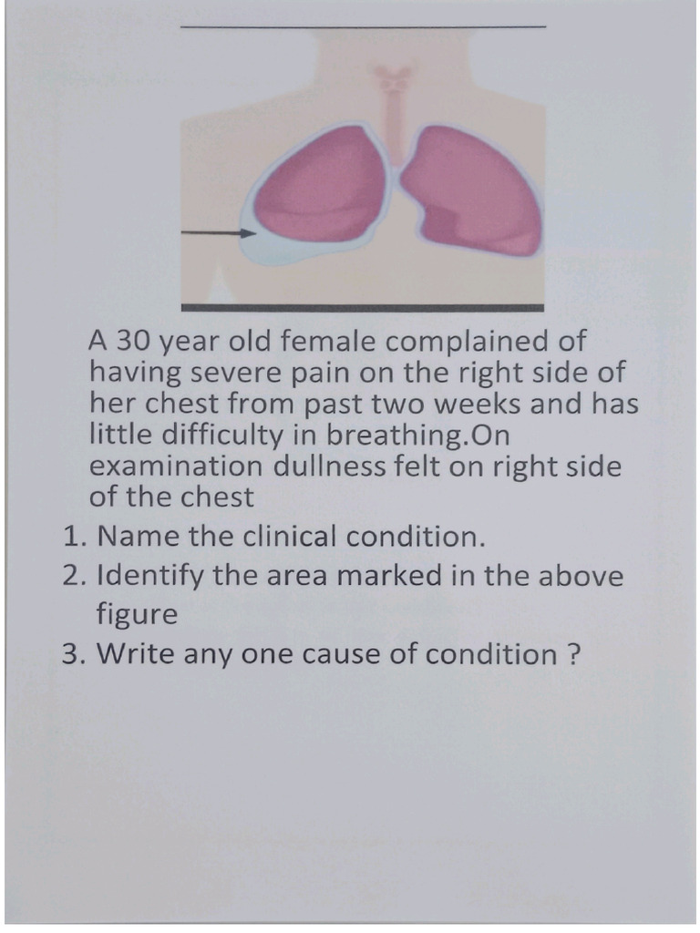Thorax Clinical Charts | PDF