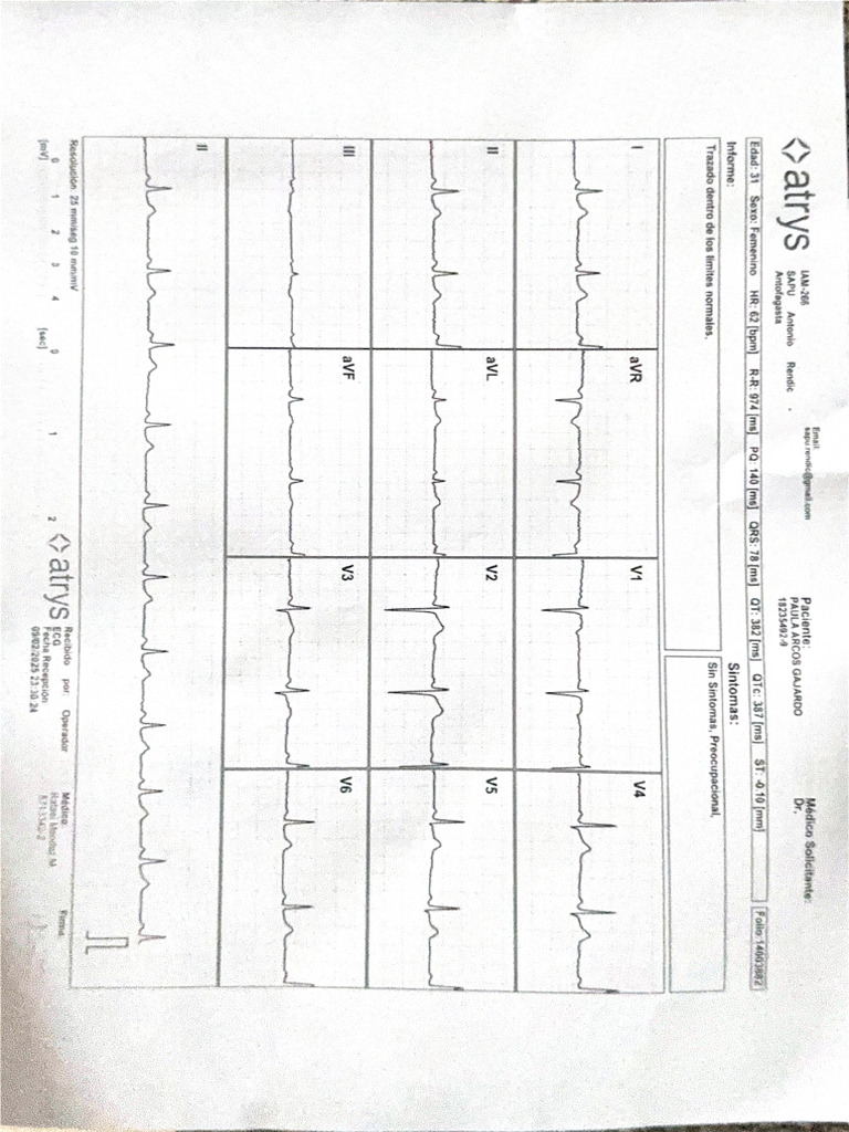 ECG | PDF
