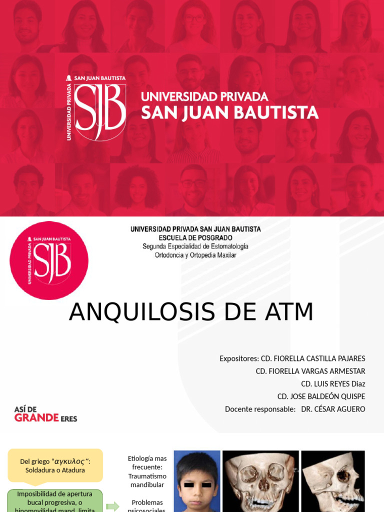 Anquilosis de ATM: Causas y Tratamiento | PDF | Articulación | Sistema ...