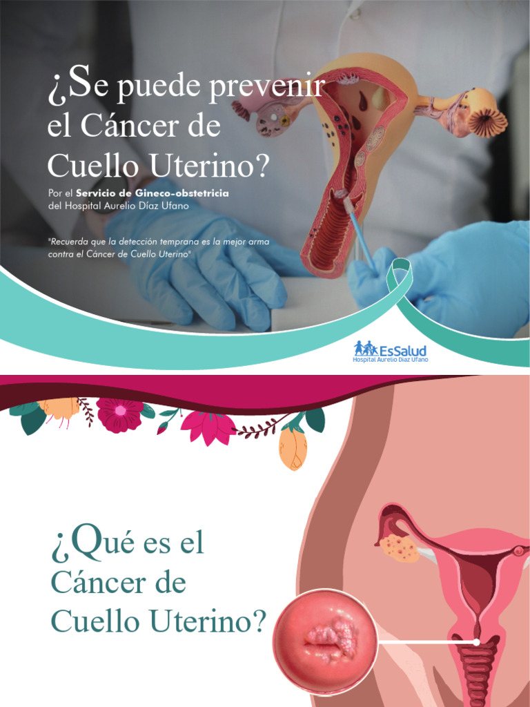 Rotafolio Cancer de Cuello Uterino | PDF