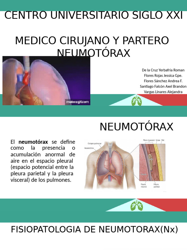 Neumotórax: Causas, Diagnóstico y Tratamiento | PDF | Pulmón ...