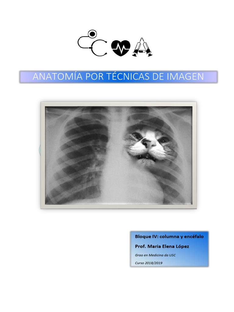 Anatomía de Columna y Encéfalo en RX | PDF | La columna vertebral ...