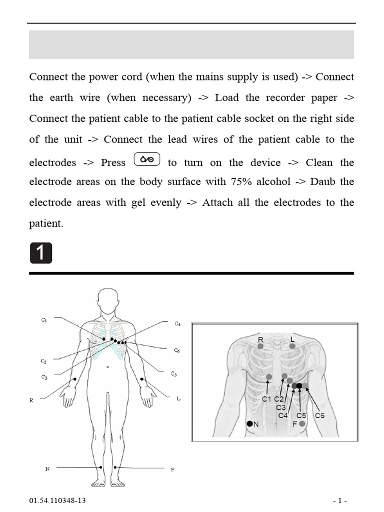 SE-601 Guia Rápida - 01.54.110348-1.3 SE-601 6-Channel Electrocardiograph Quick Reference Card ...