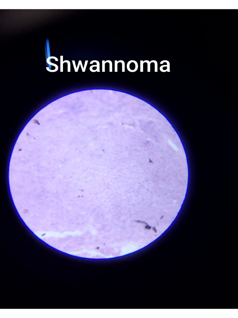 Patho slides_241126_103758 | PDF